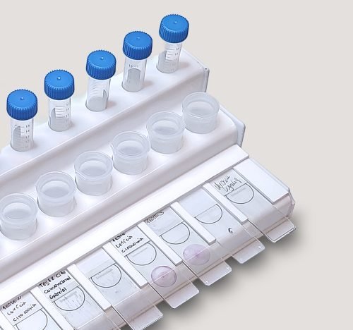 Cytoliq Rack - Cytoliq - Liquid-Based Cytology Products