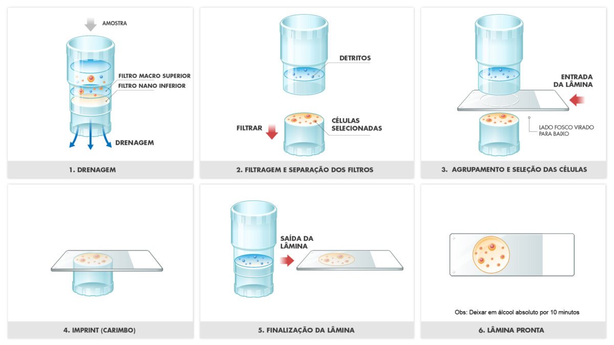 Citologia em Base Líquida: Saiba disso antes de implementar no seu ...